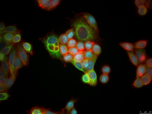 HCC95 Human Lung Squamous Carcinoma Cell Line | SCC483